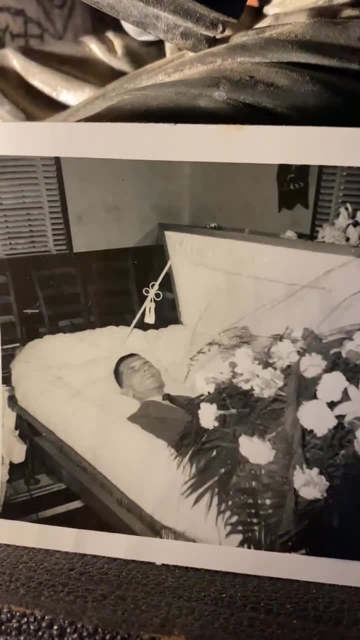 Left Eye In Open Casket