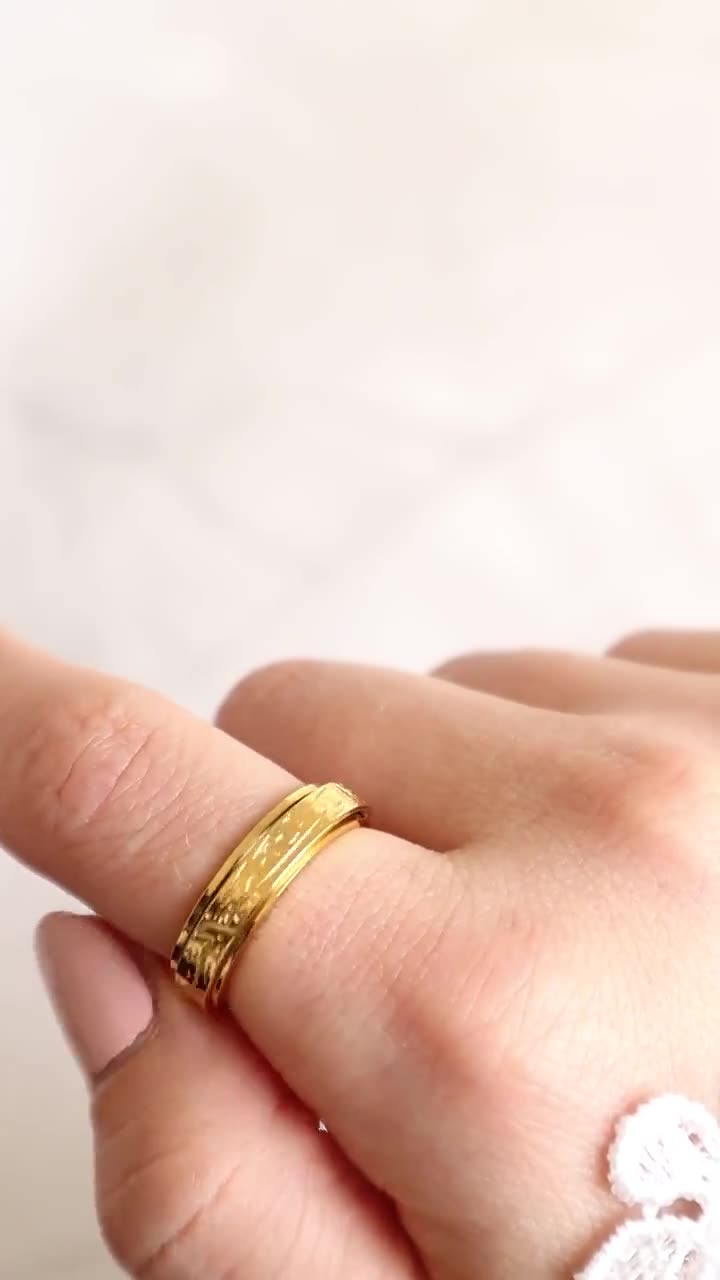 Can i wear my gold wedding ring during an mri | Honestweddingadvice.com
